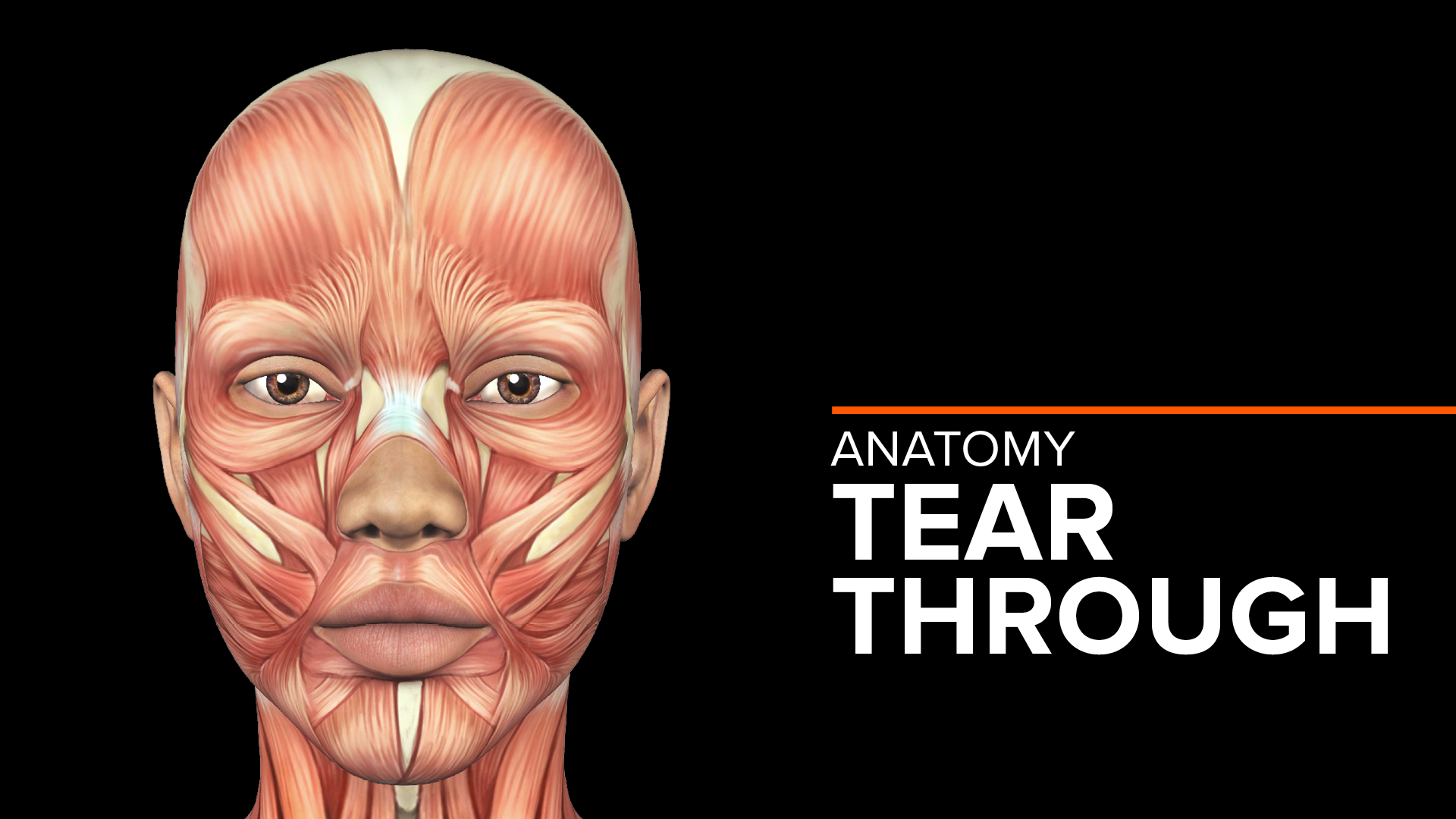 Anatomy Tear Trough | Merz Aesthetics Medical Forum