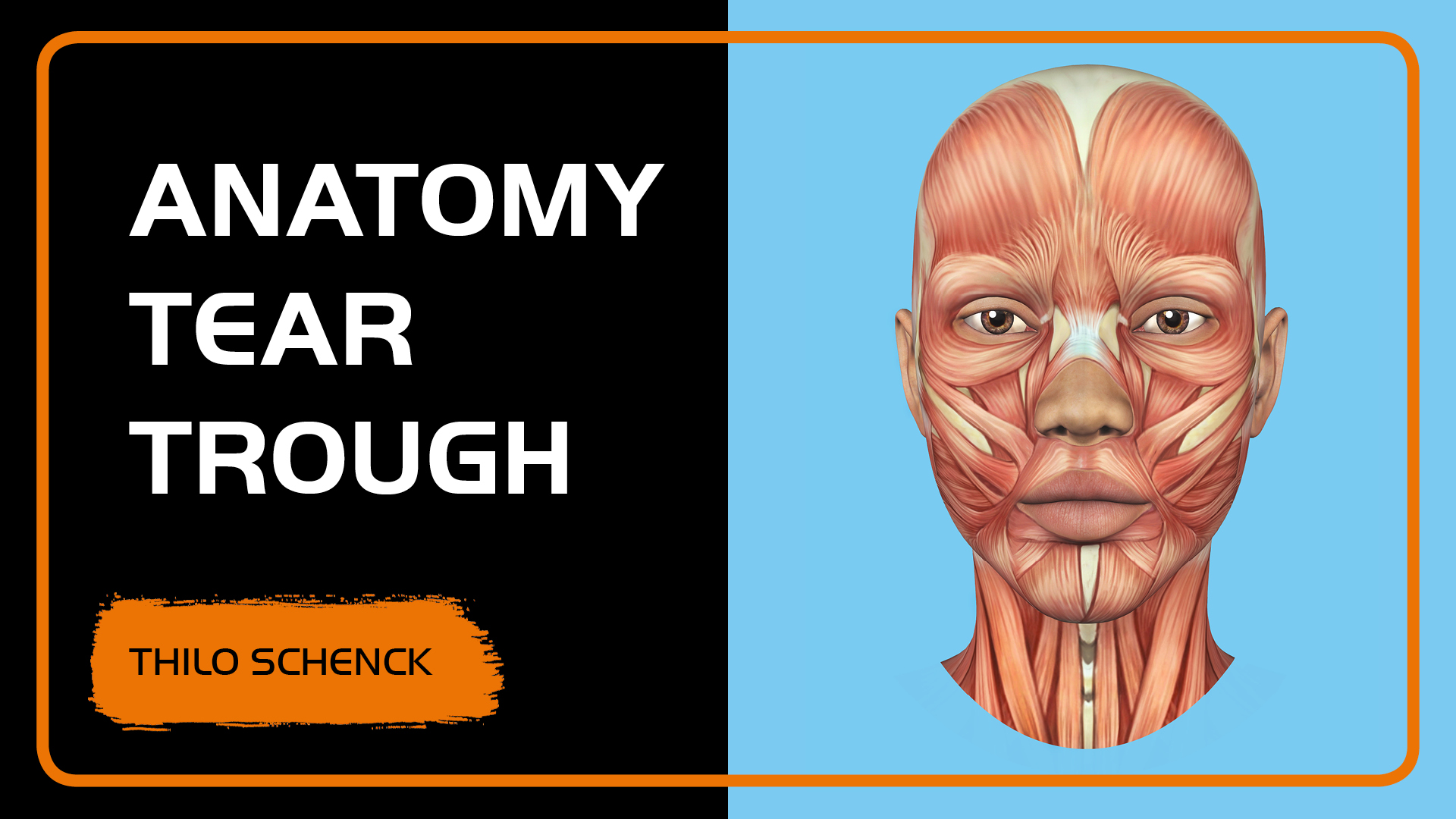 Anatomy Tear Trough | Merz Medical Forum